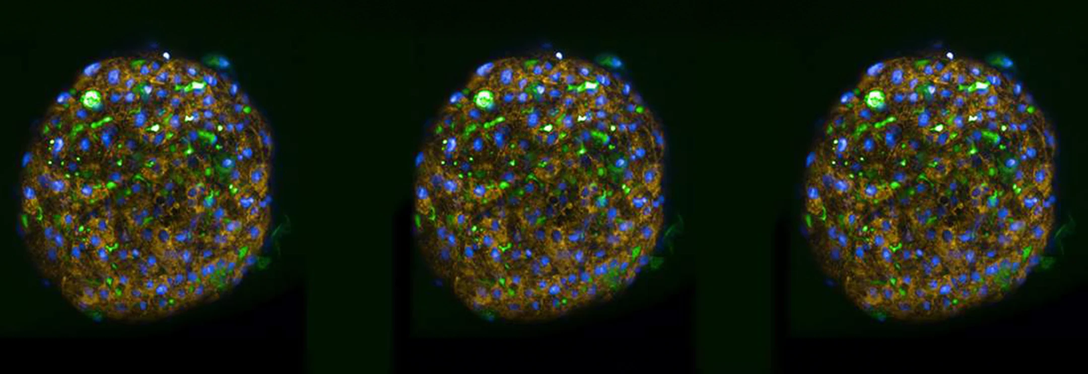 Confocal Imaging | Revvity