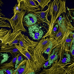 High-Content Screening (HCS) Assays | Revvity