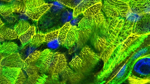 Physiological Model Solutions | Revvity