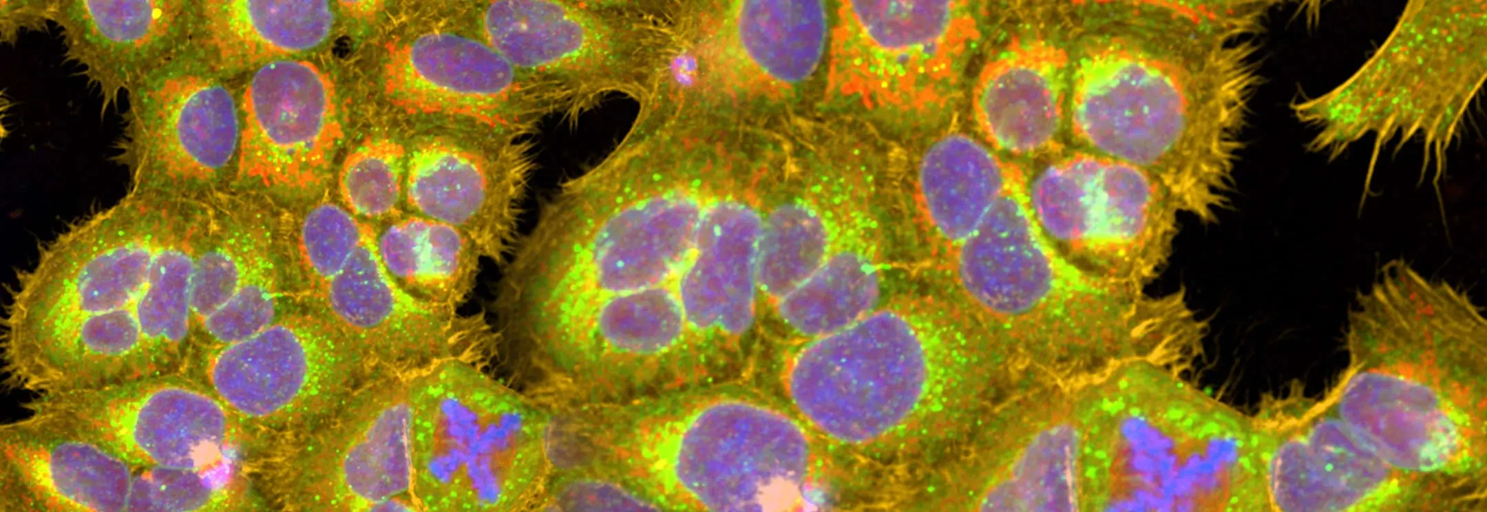 Cell Painting| Revvity