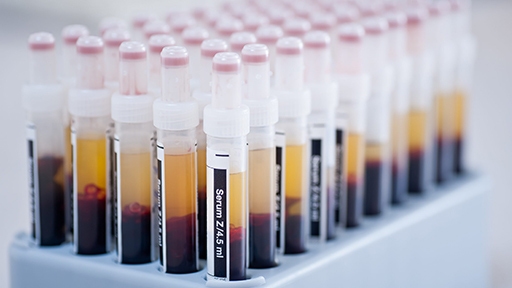 Automated circulating cell-free DNA purification with the chemagic 360 ...