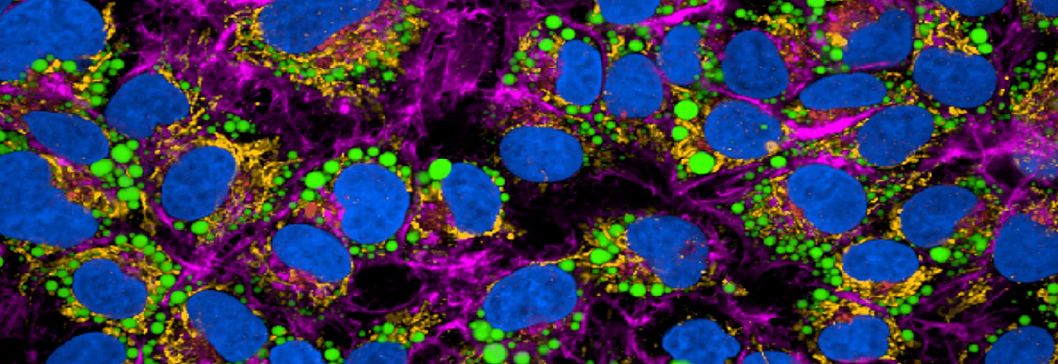 Cell Imaging Reagents | Revvity