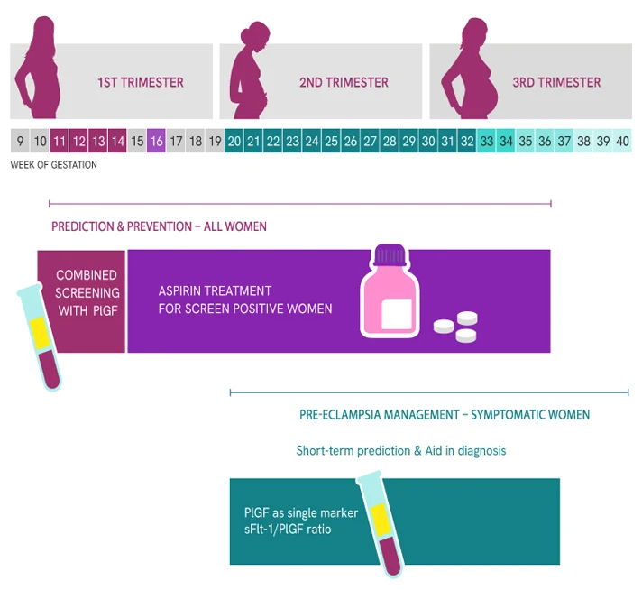 Preeclampsia Management - Prediction and aid in diagnosis of ...
