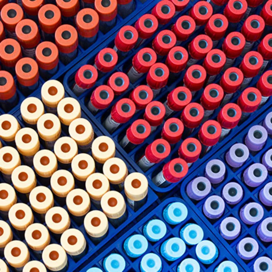 Automation solutions for IVD workflows | Revvity