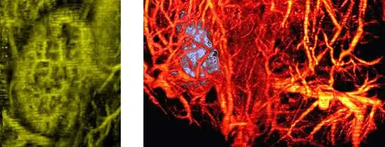 VesselVue Microbubble Contrast Agent | Revvity