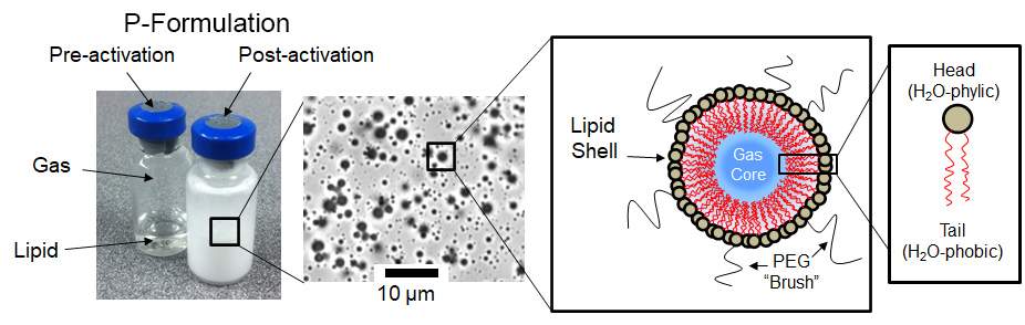 VesselVue Microbubble Contrast Agent | Revvity