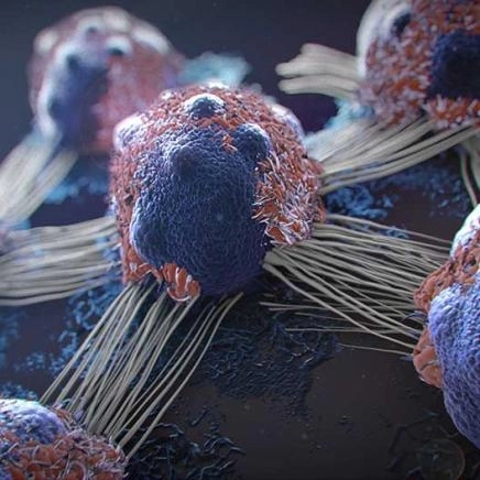 Cancer Diagnostics & Research Solutions | Revvity