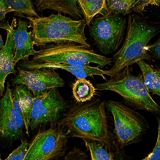 Cell Analysis Solutions and Products | Revvity