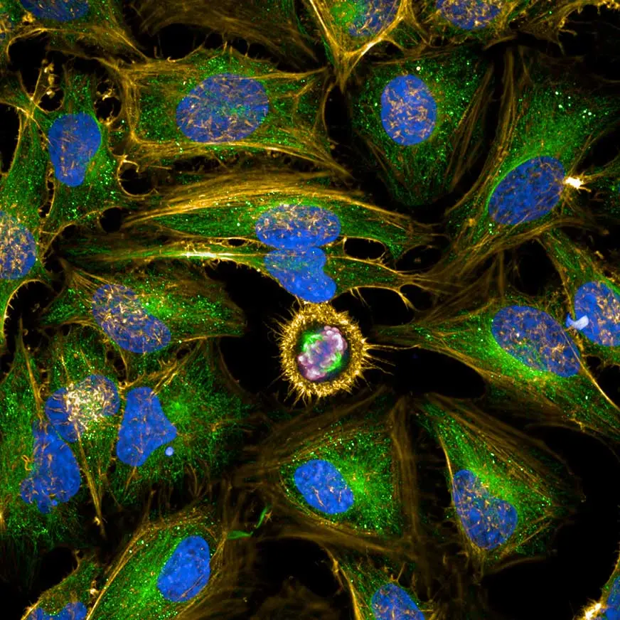 Cell-based solutions for cancer research | Revvity