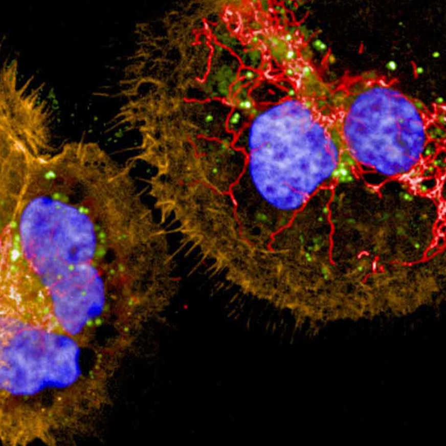 Cellular Imaging & Analysis Systems | Revvity