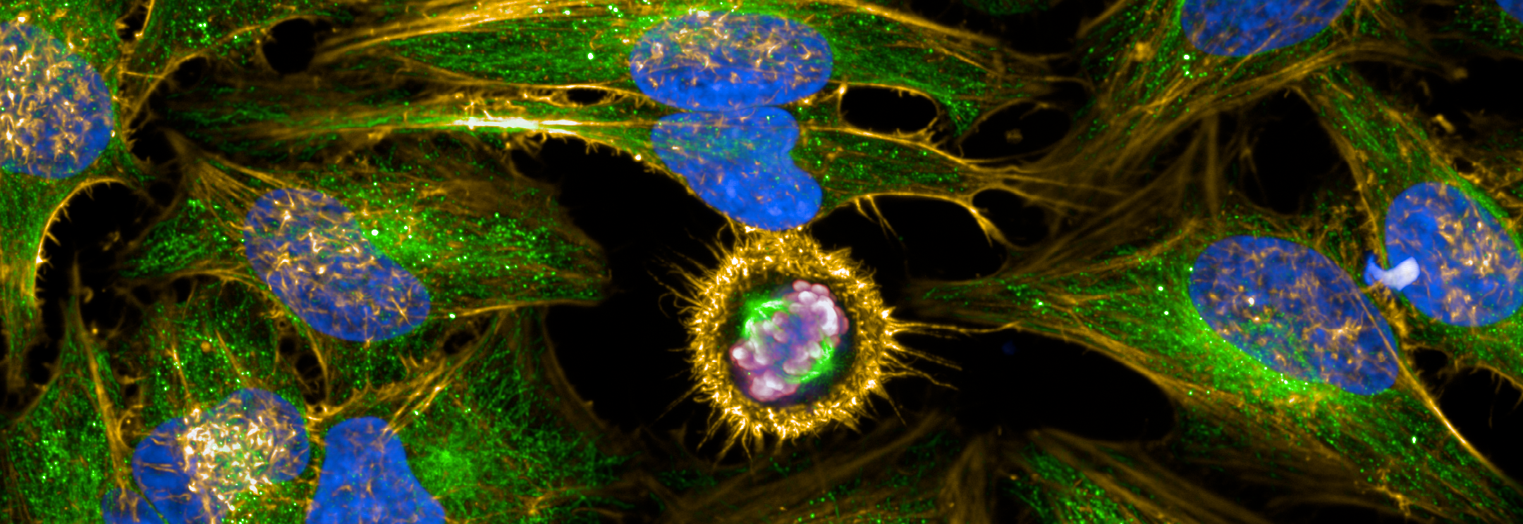 Cell Imaging Applications | Revvity