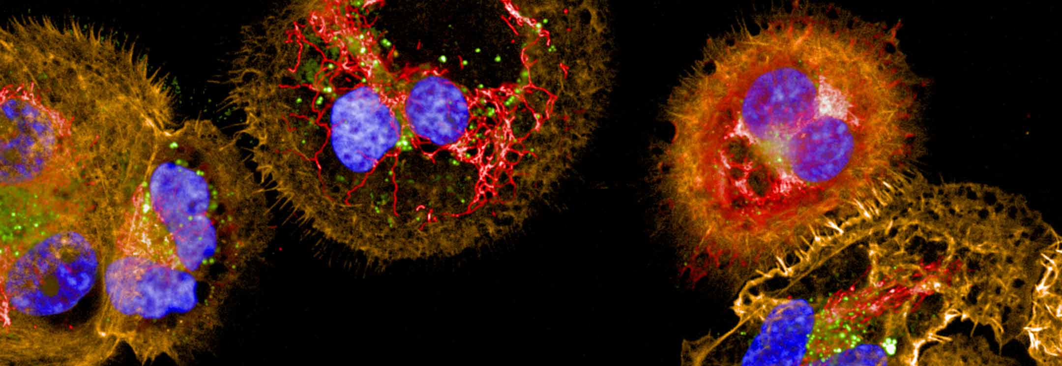 Cellular Imaging & Analysis Systems | Revvity