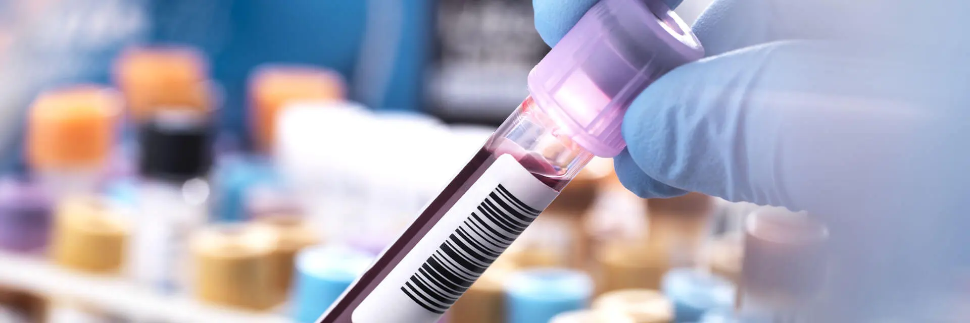 Enabling high quality testing for all clinical laboratories | Revvity