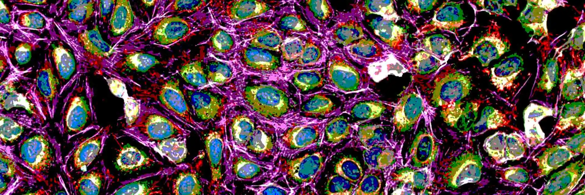 Applying Functional Genomics Strategies To High Content Phenotypic