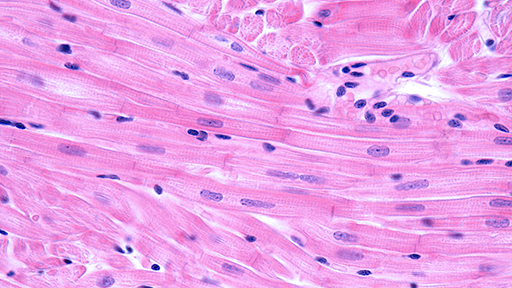 Protein Extraction Efficiency Bead Mill Lysis | Revvity