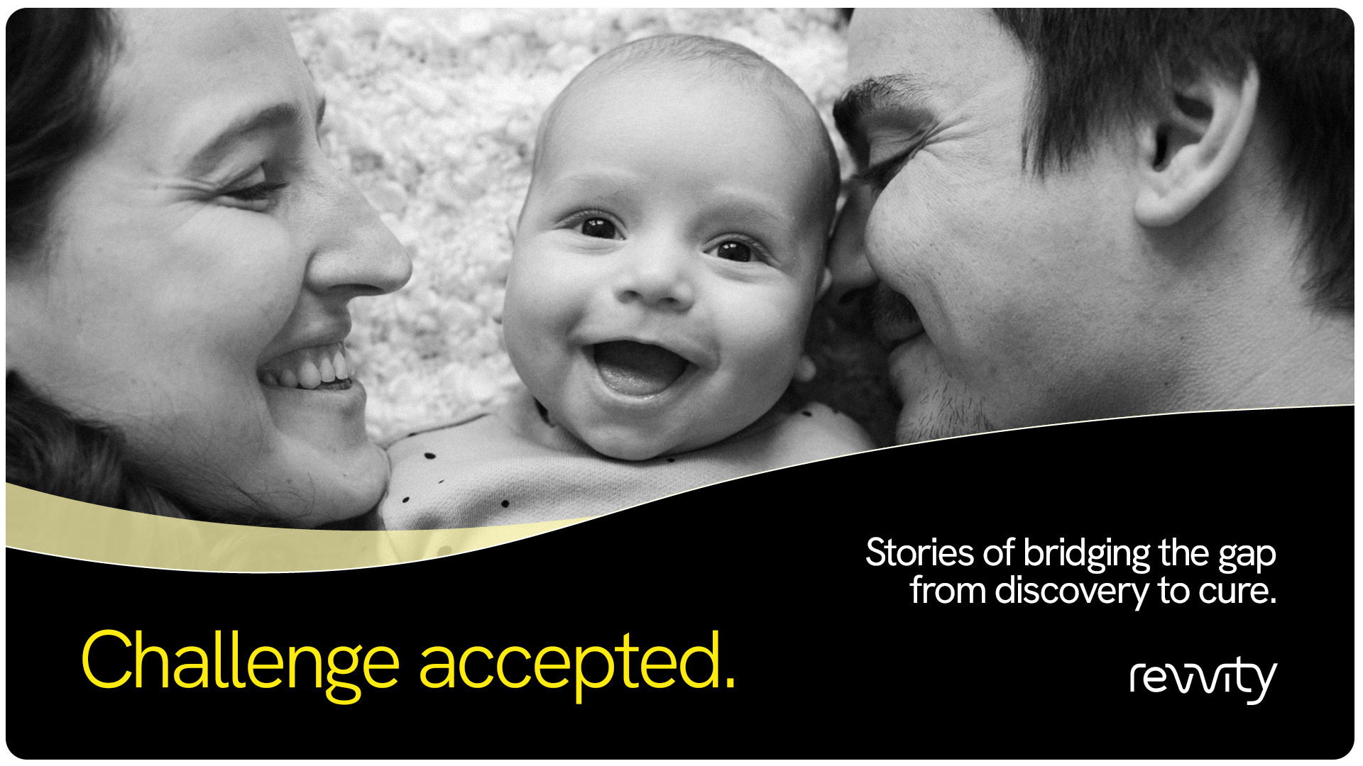 The power of early: why spinal muscular atrophy demands faster newborn screening. | Revvity