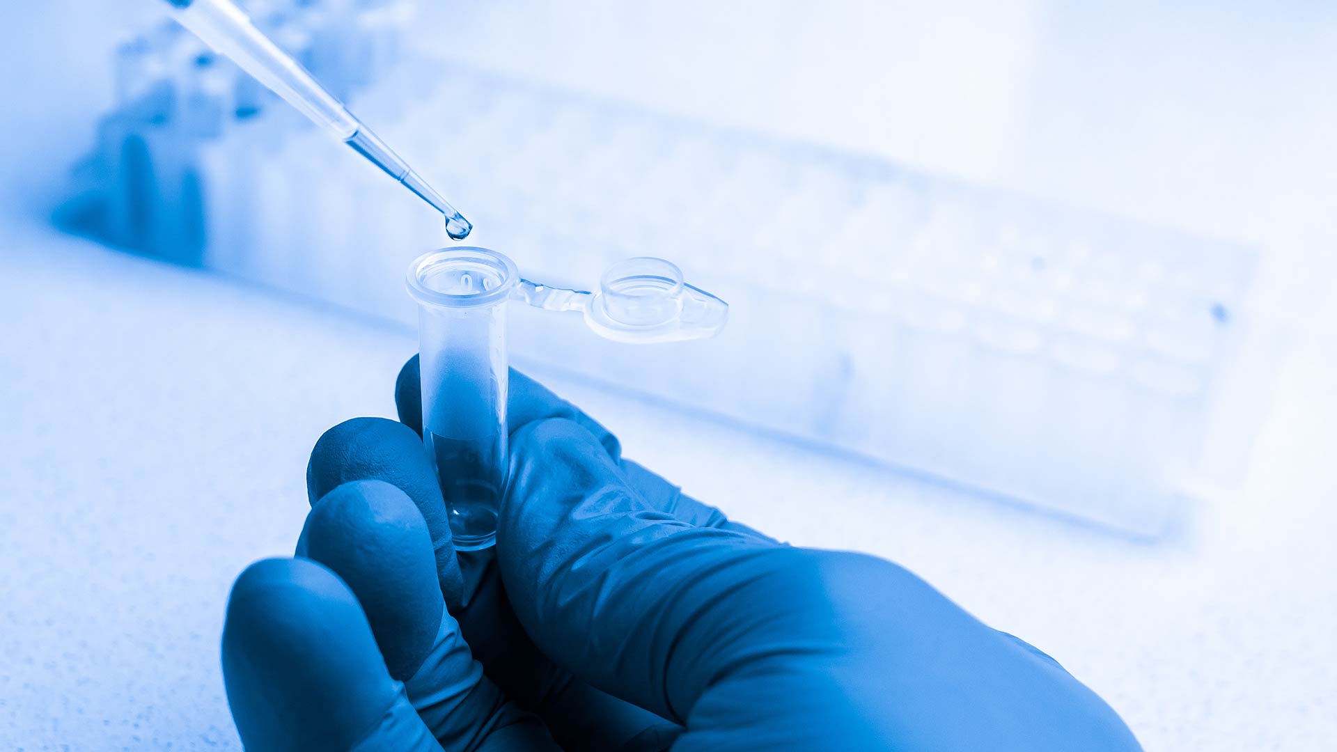 Diagnostic microbiology and infectious diseases in 2026: why front-end ...