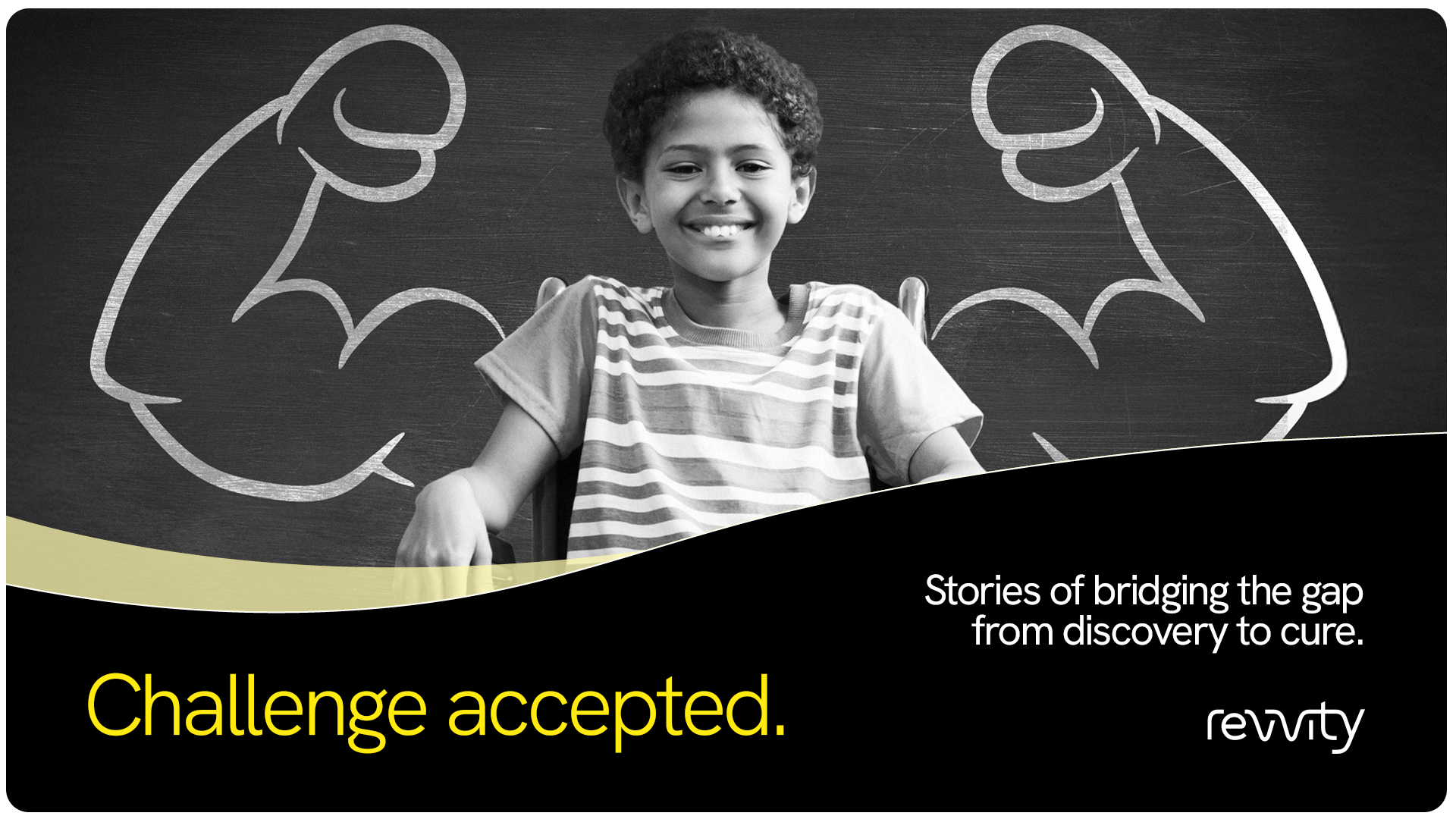 No time to lose: the fight for early DMD detection. | Revvity