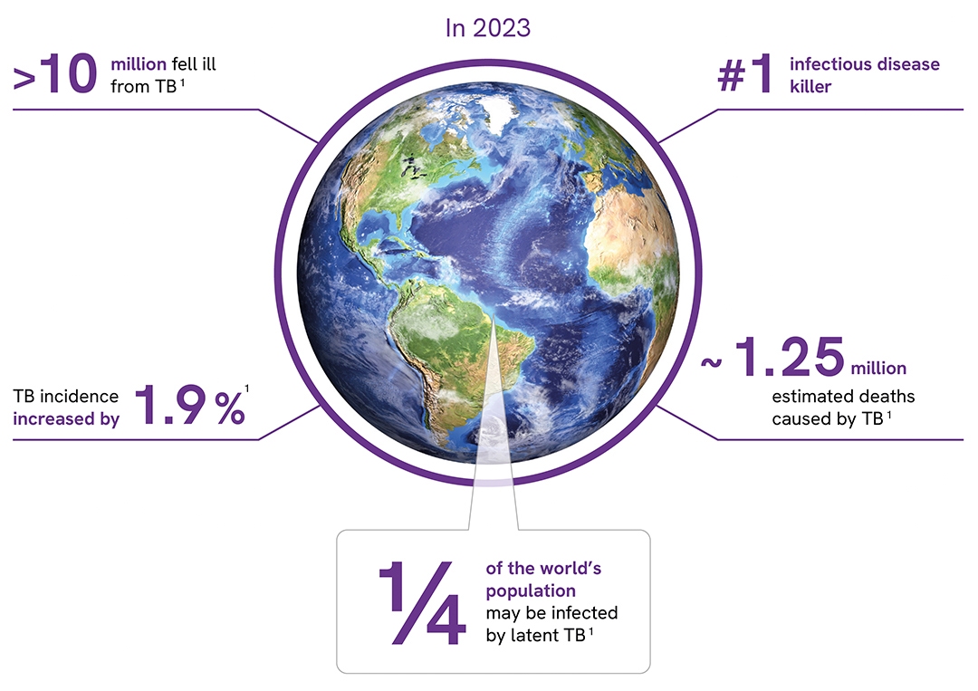 Tuberculosis Management | Revvity