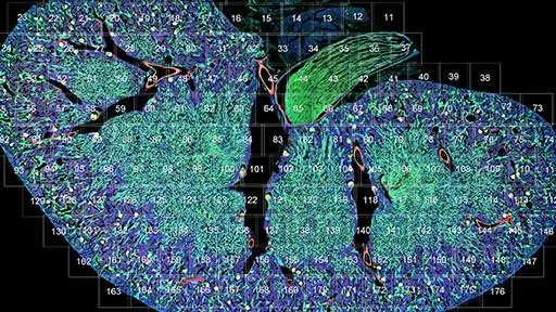 3D Cell Model Imaging and Analysis | Revvity