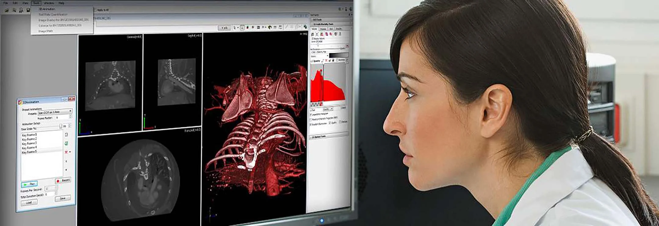 In Vivo Imaging Software - Living Image | Revvity