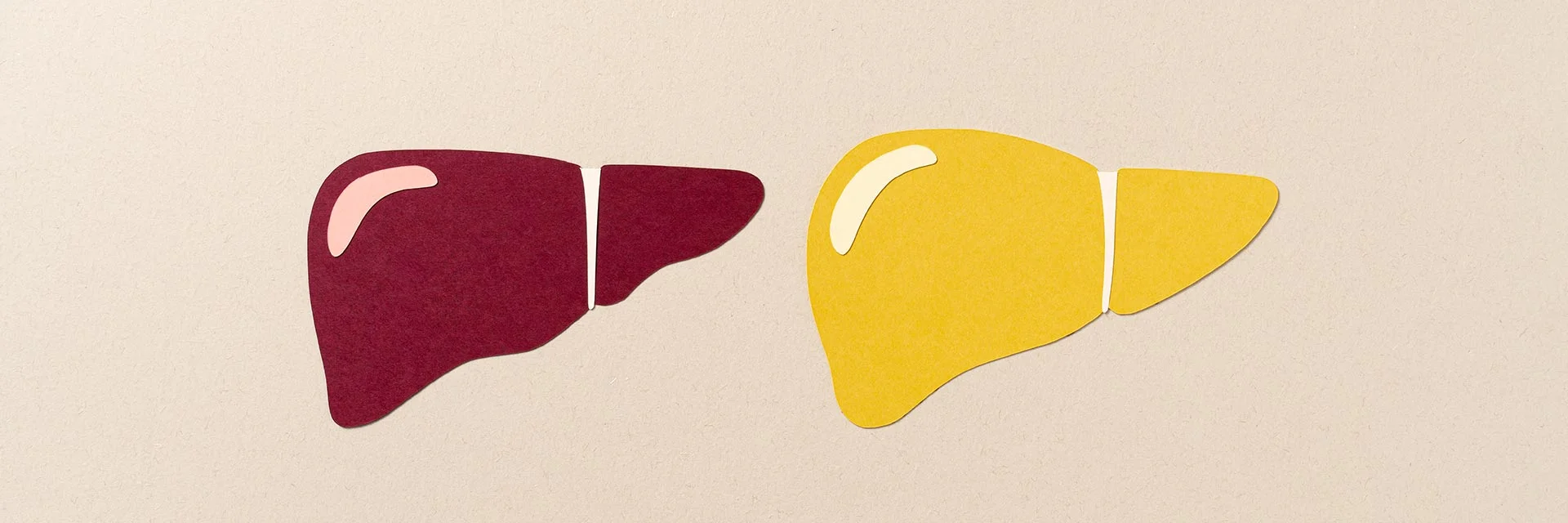 Nonalcoholic fatty liver disease (NAFLD) | Revvity