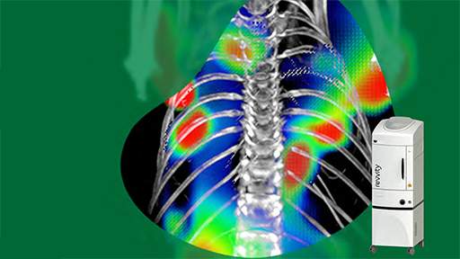 In Vivo Imaging | Revvity