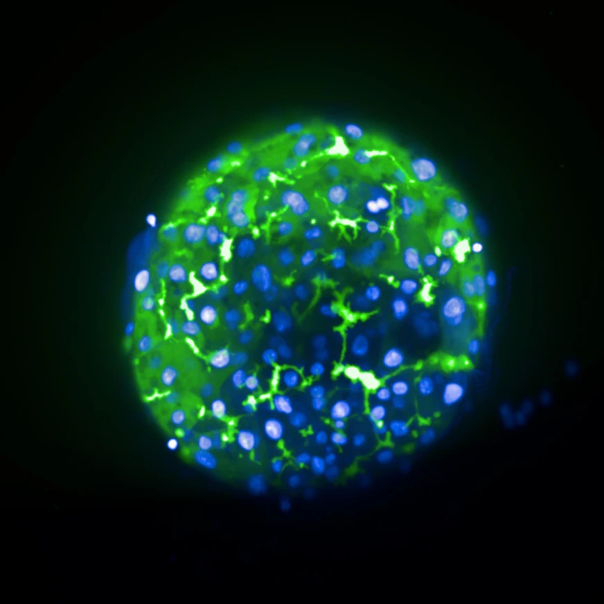 Physiological Model Solutions | Revvity