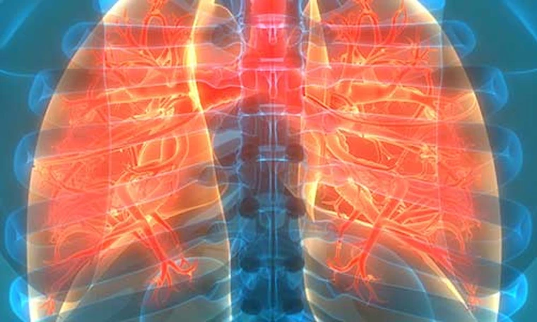 Respiratory SARS-CoV-2 RT-PCR Panel 1, 96 rxns | Revvity