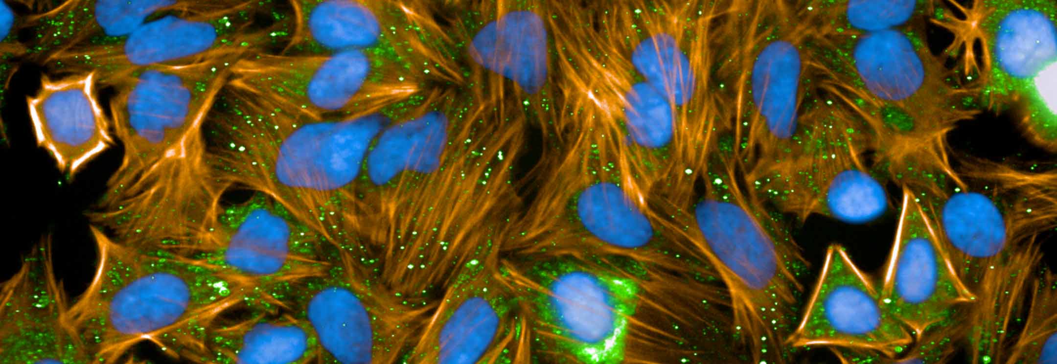 Water Immersion Objectives | Revvity